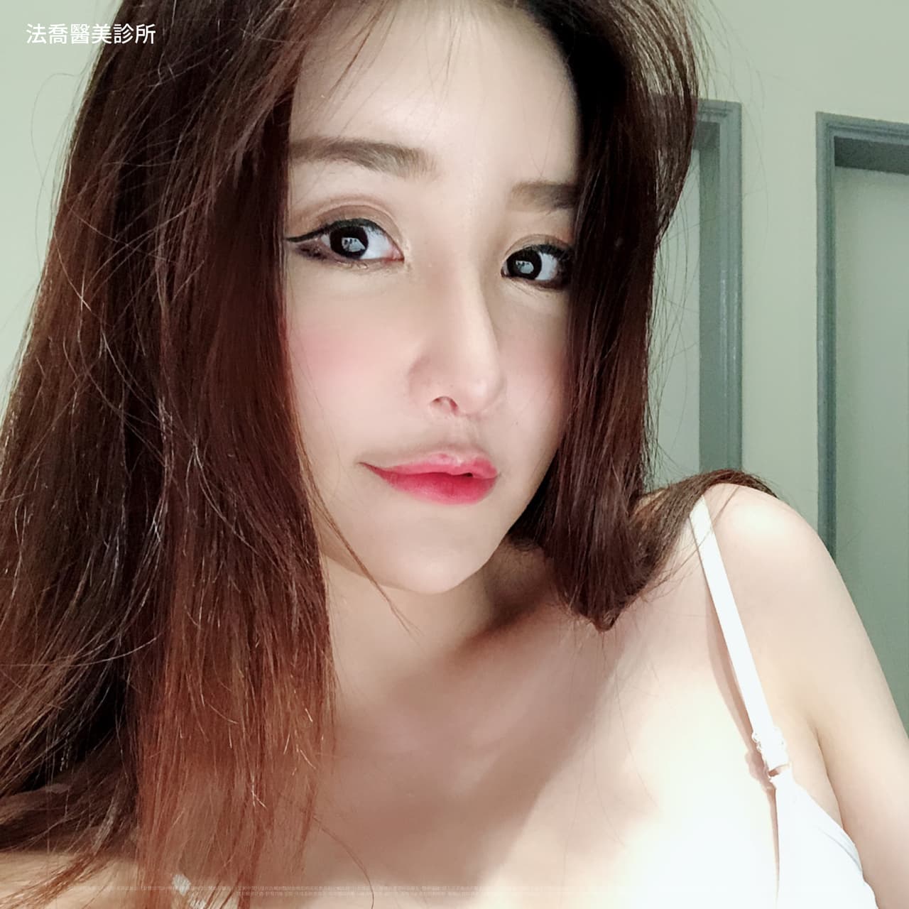 近期隆鼻趨勢是這種鼻型！小模直接變身高顏值JKF女郎！ - 法喬醫美診所 (@facharming) | Dcard