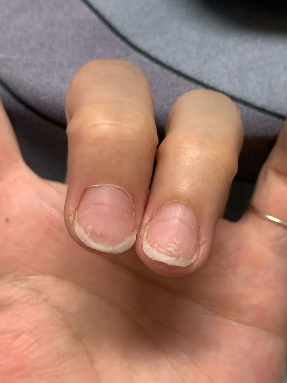 問題 請問我的指甲🥹 美甲板 Dcard