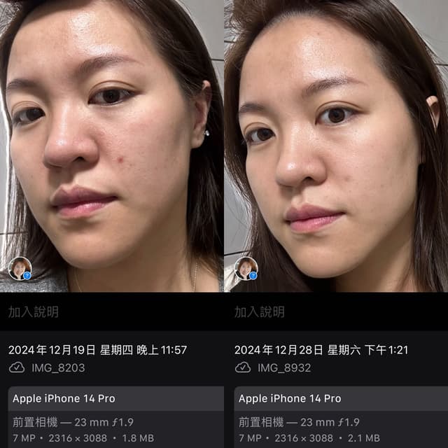 #分享 真的好想白！！！SKII小燈泡精華＋理膚Mela B3 - 美妝板 | Dcard