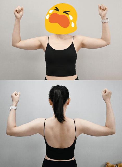 告別肥手臂+厚副乳！手臂抽脂滿意分享！ - 品牌商家 (@brand_selection) | Dcard