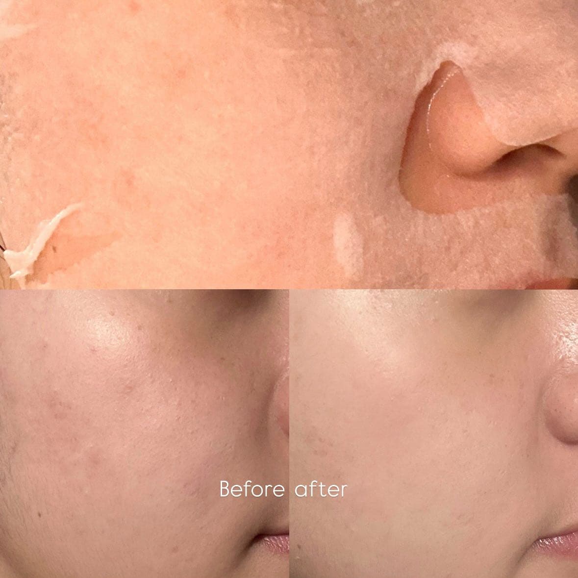 SHIMBI METHOD 審美之選 30%B3緊緻全能精華｜外泌體精華面膜｜毛孔有效細緻🧖🏻‍♀️ ˟ ̫ 🪽 ヾ - 贊助板 | Dcard