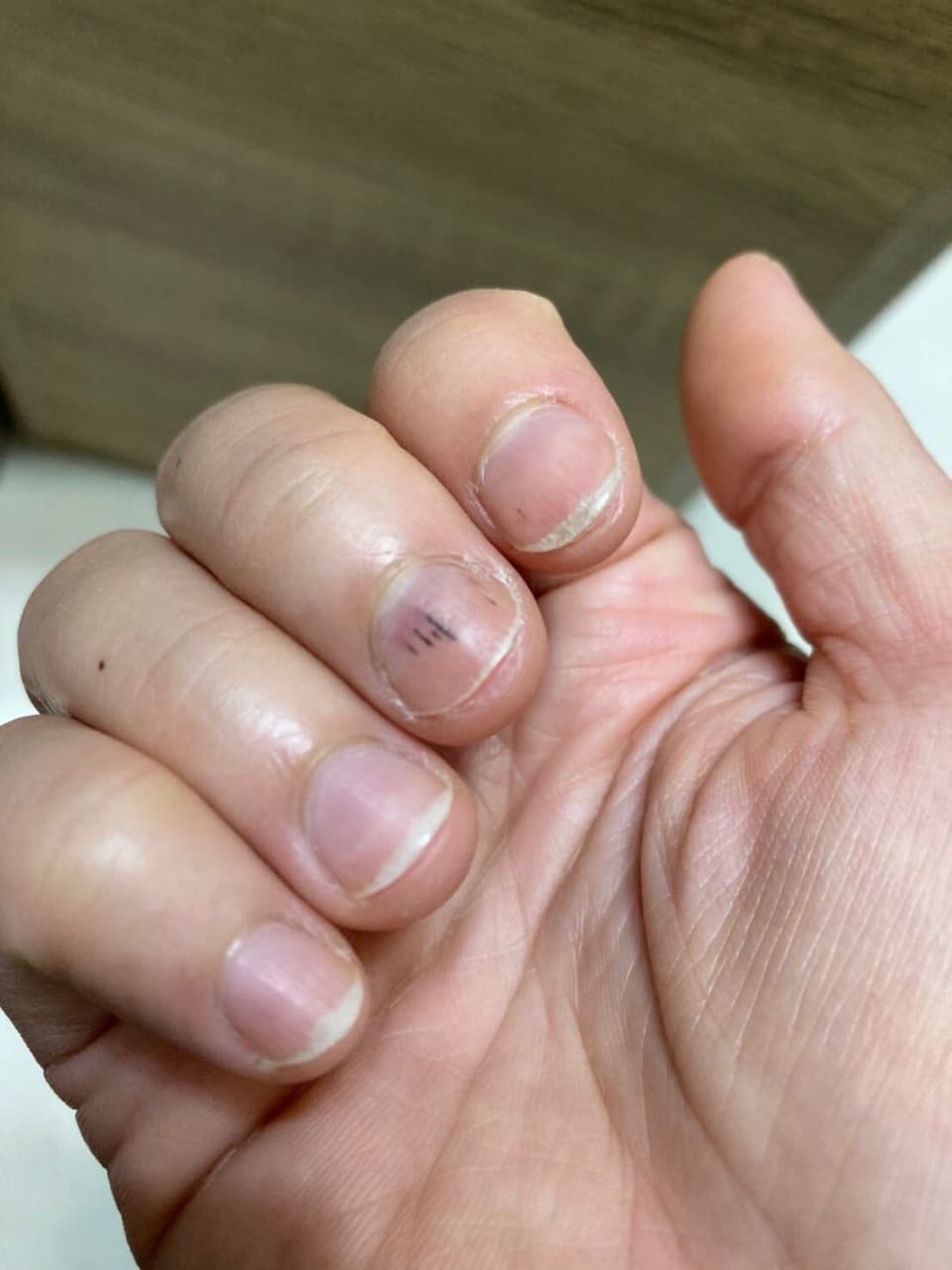 問題 指甲裡的奇怪線條 美甲板 Dcard