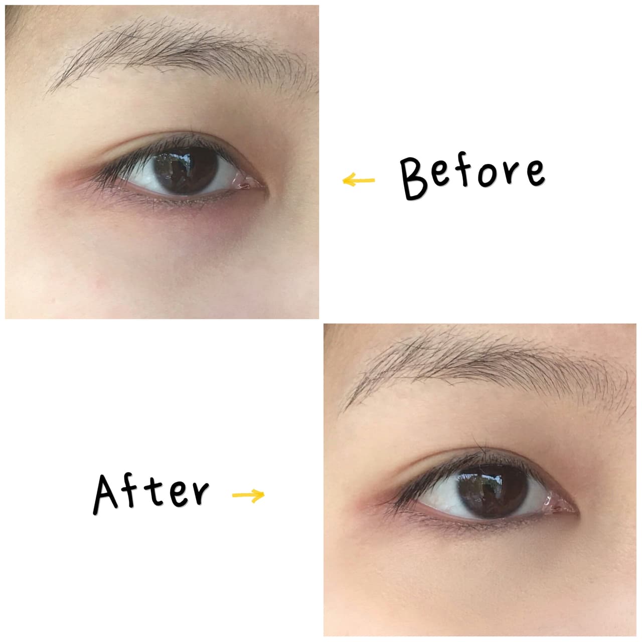 #分享 近期愛用遮瑕大公開 | MEDI247 - 美妝板 | Dcard