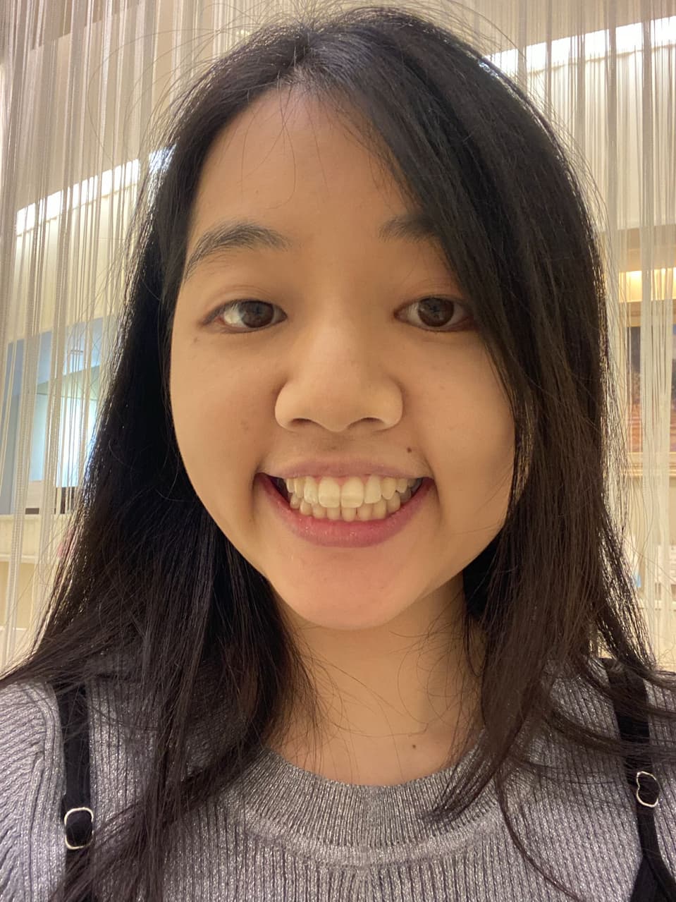 #分享 SOV數位隱形矯正畢業 - 牙齒矯正板 | Dcard