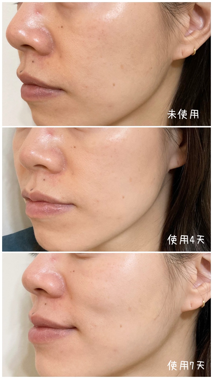 淡斑小天才 ️ ️倩碧淡斑精粹很可以吧🏆 - 美妝板 | Dcard