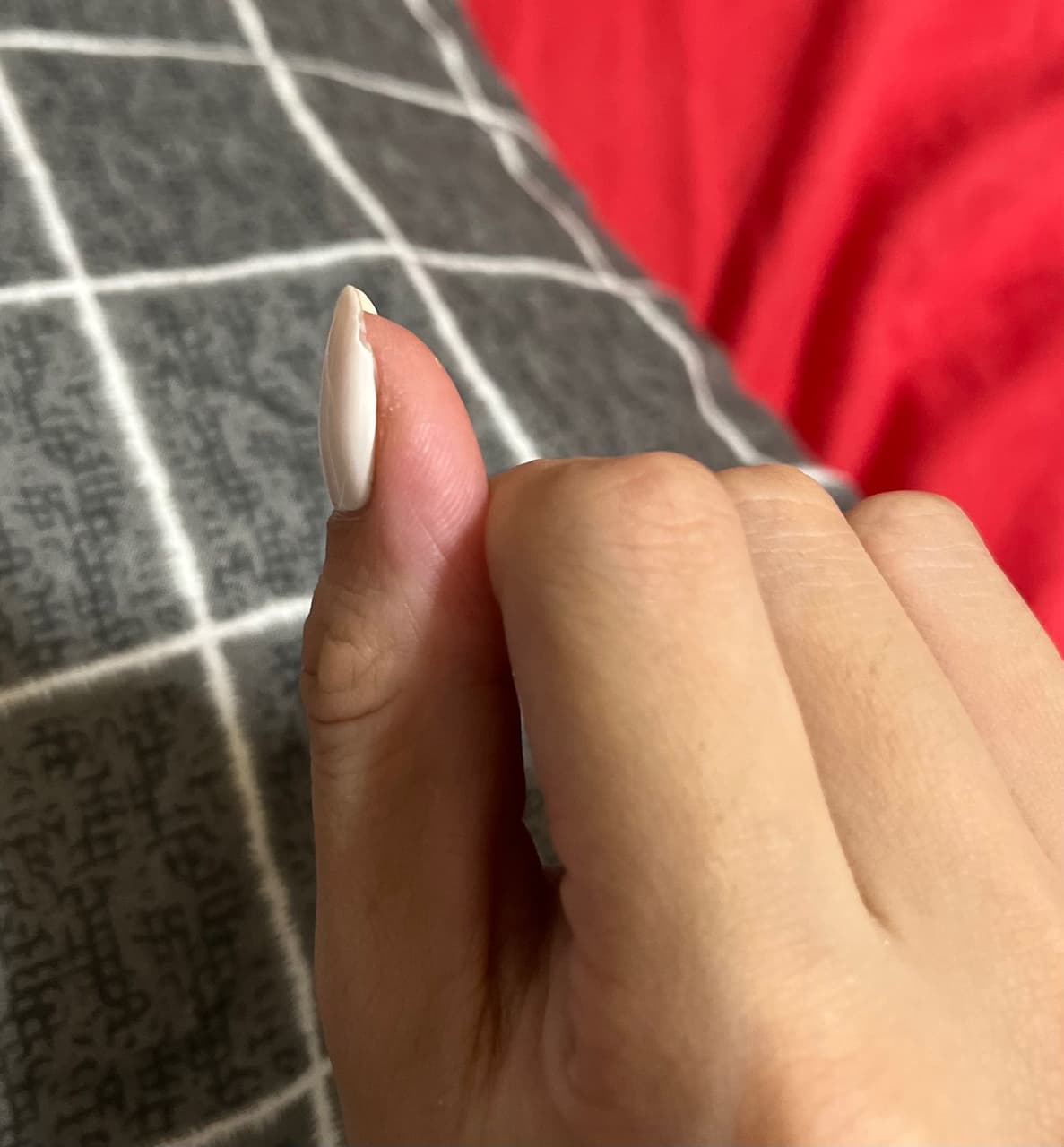 問題 想請問這樣是正常的嗎 美甲板 Dcard