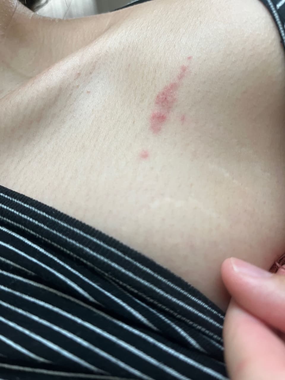 發問 發問 常常在家裡莫名被咬之前有被禽蟎咬過但這次好像不太一樣求問這到底是什麼蟲咬 問答板 Dcard