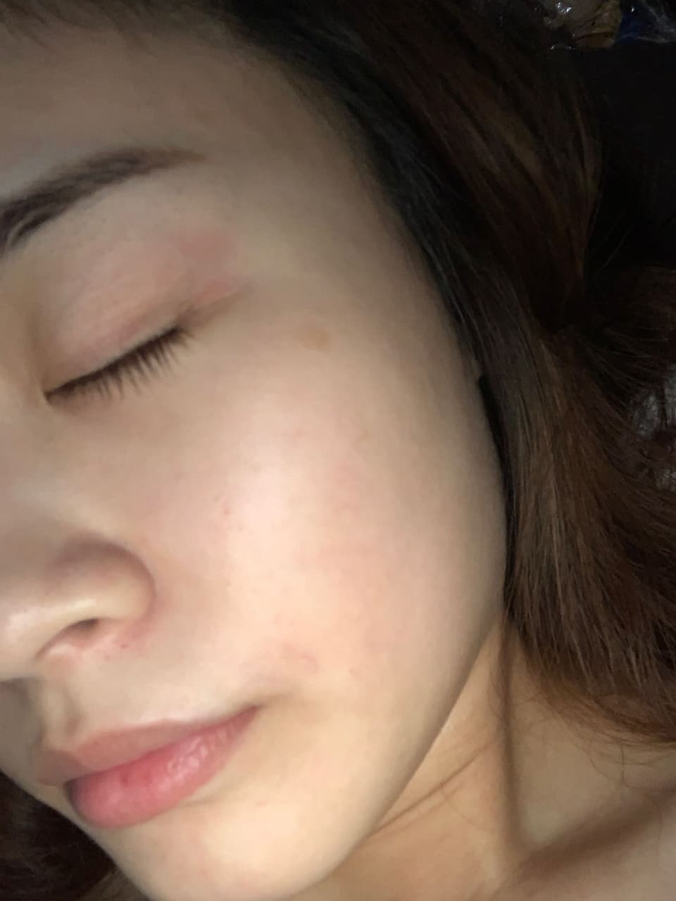 大家的毛孔有多大？ - B160 留言 | Dcard