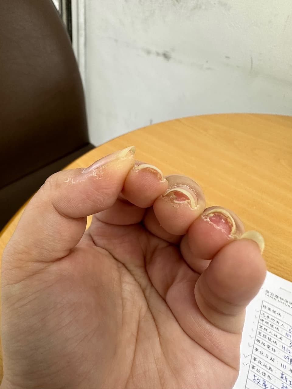 問題 詢問手這樣是怎麼回事? 美甲板 Dcard