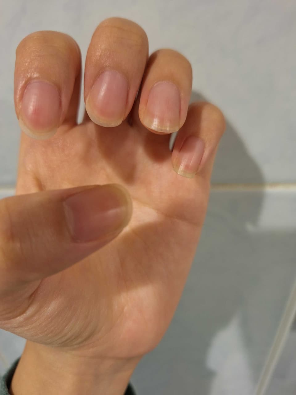 問題 求救!請問這到底是不是甲床分離 美甲板 Dcard