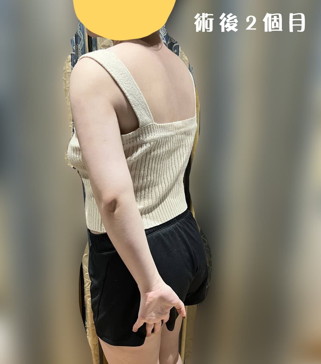 #分享 想在婚禮上穿好看的禮服當個漂亮的新娘子！ - 晶美整形 (@skin1000) | Dcard