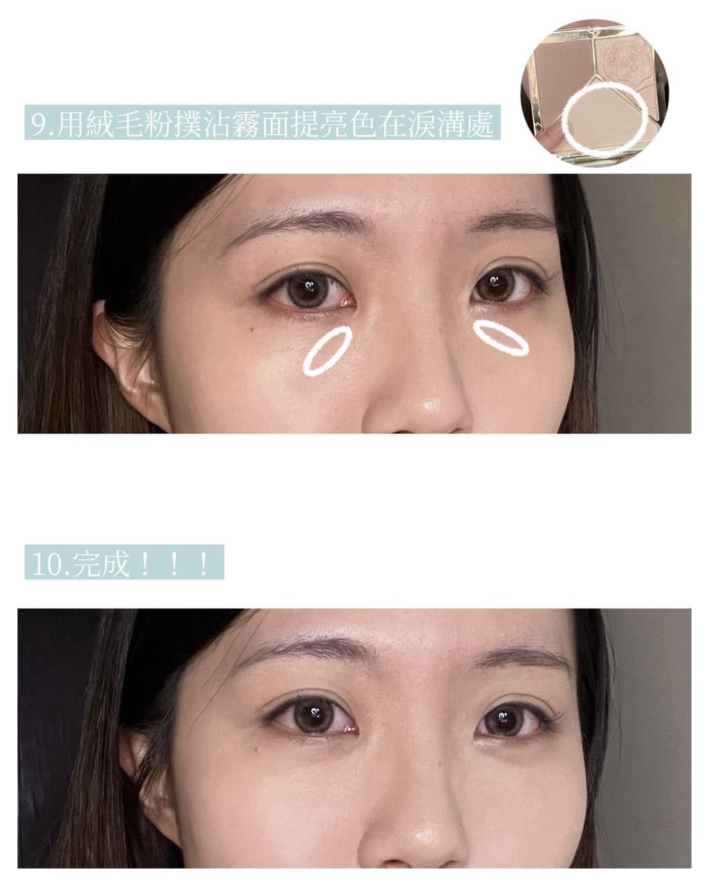 終於～！從黑眼圈淚溝系畢業😭 - 璇 (@cathycrazyyy) | Dcard