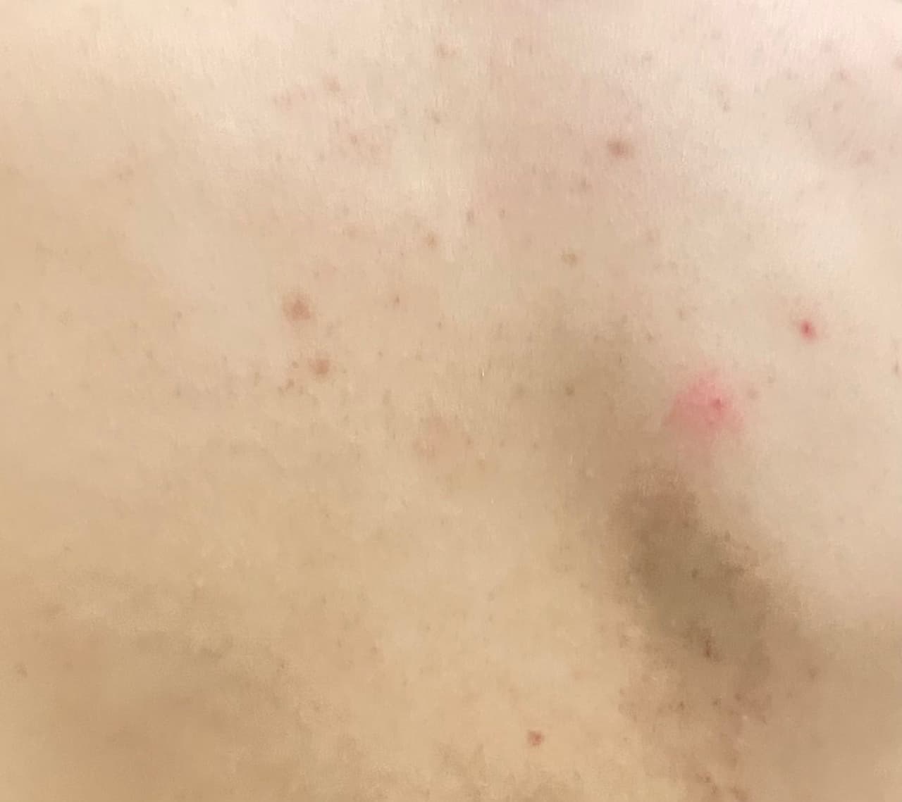 「NOT4U｜柔嫩煥白保濕噴霧」使用心得 - 購後評價板 | Dcard