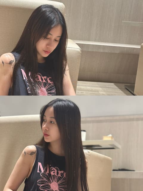 #分享 韓國眼袋內開重修及補脂 完全恢復🫰🏻 - 醫美板 | Dcard