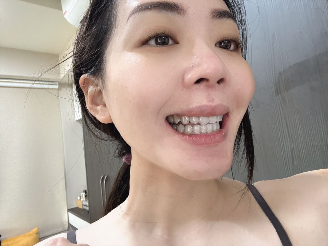 牙齒整齊但嘴凸 牙齒矯正畢業🎓（2更2025/4/13） - 牙齒矯正板 | Dcard