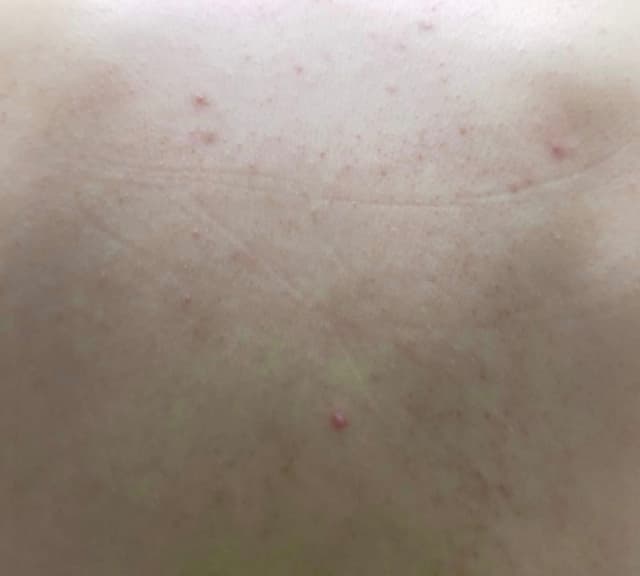 #評價 「NOT4U｜柔嫩煥白保濕噴霧」使用心得 - 購後評價板 | Dcard