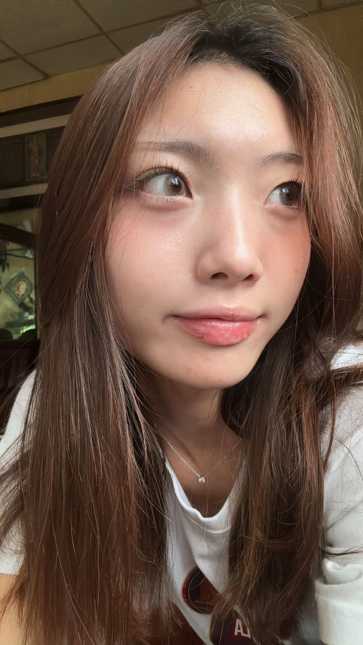 #分享 口服A酸歷程 - 閒聊板 | Dcard