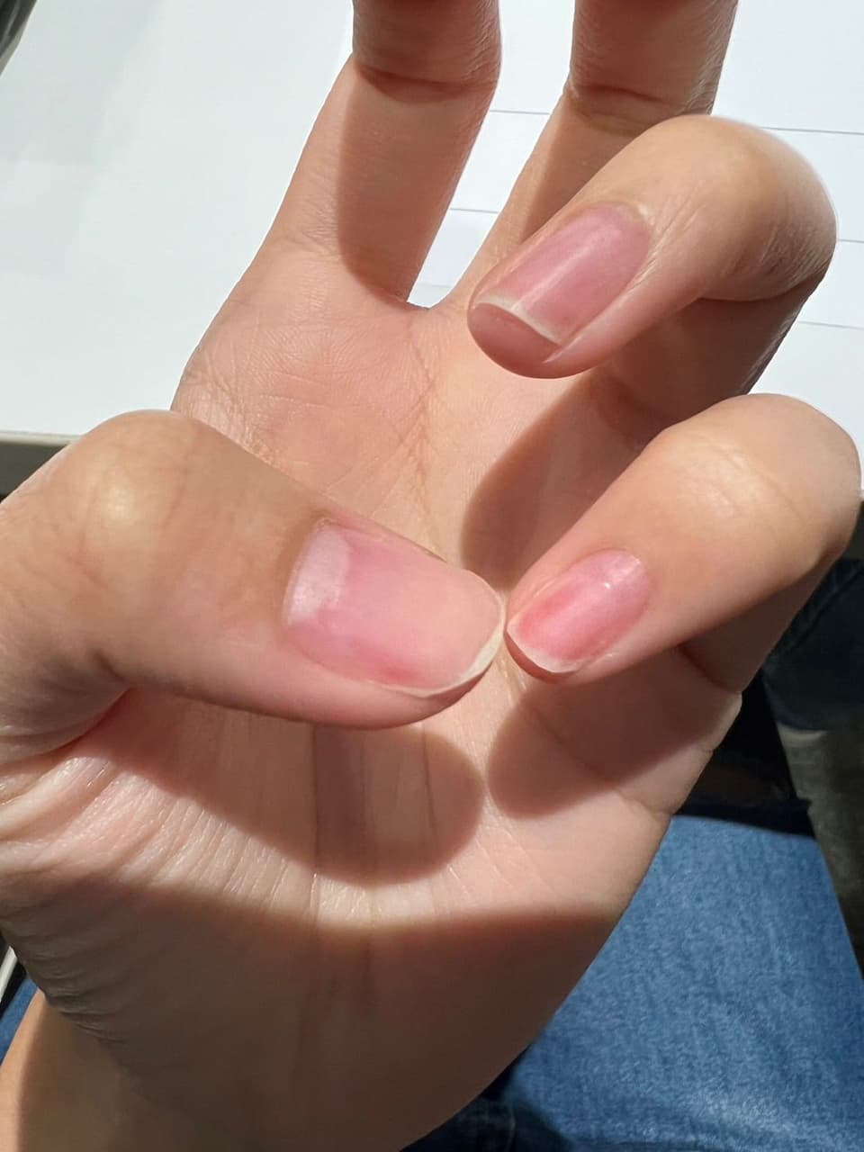 分享 這樣是受傷了嗎 美甲板 Dcard
