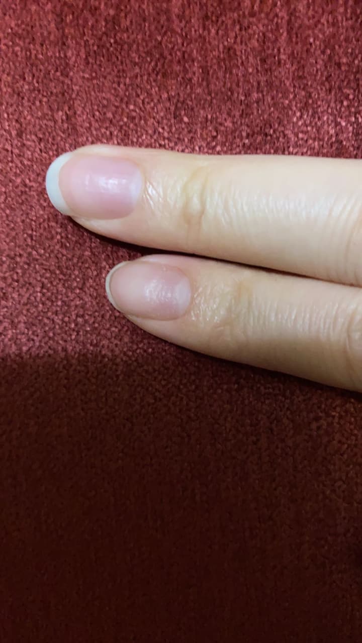 問題 問 想問有人指甲也會這樣嗎? 美甲板 Dcard