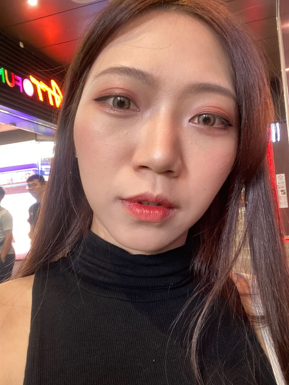 #分享 異體真皮粉解決了我牙套法令紋問題 - 醫美板 | Dcard