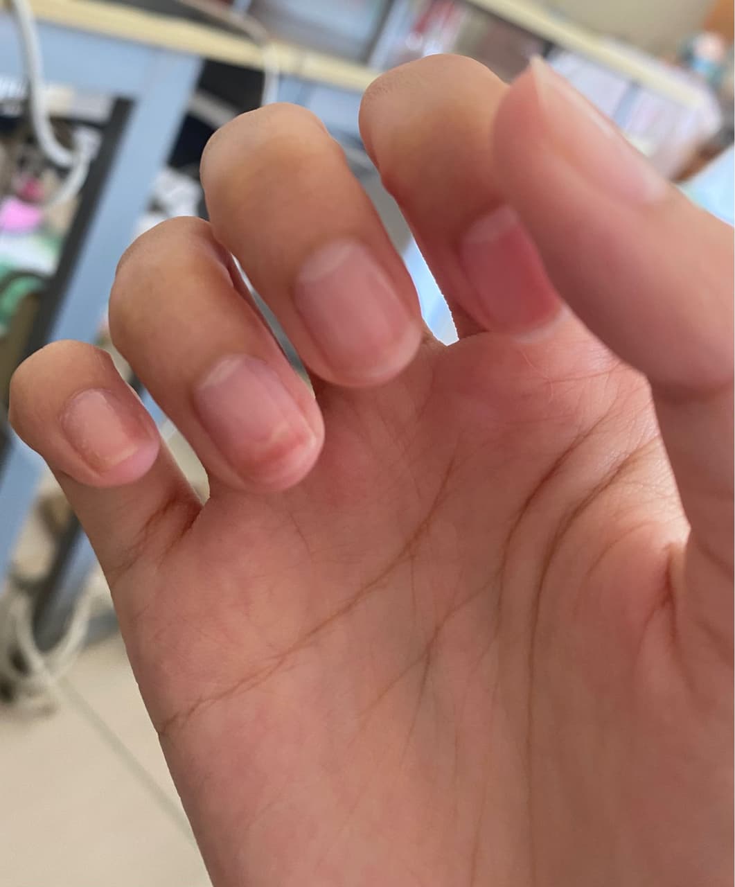 問題 請問指甲這樣還能做美甲嗎? 美甲板 Dcard