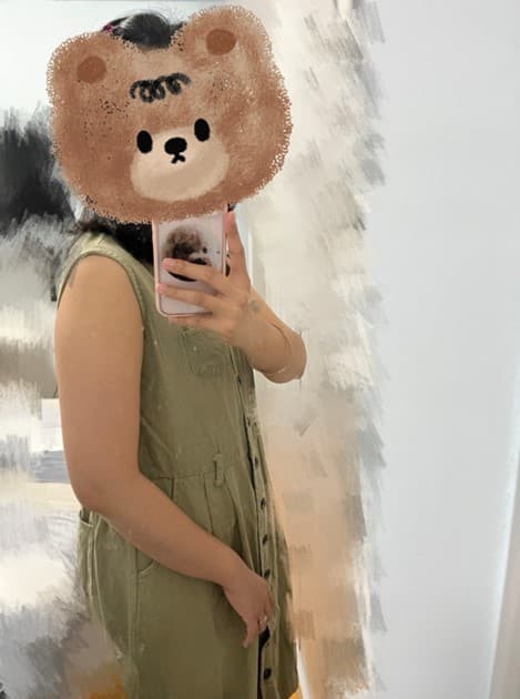 分享想要的纖細手臂 - 晶美整形 (@skin1000) | Dcard