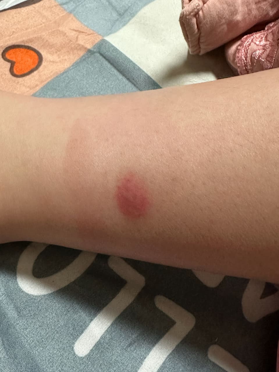 發問 這是什麼咬的 問答板 Dcard