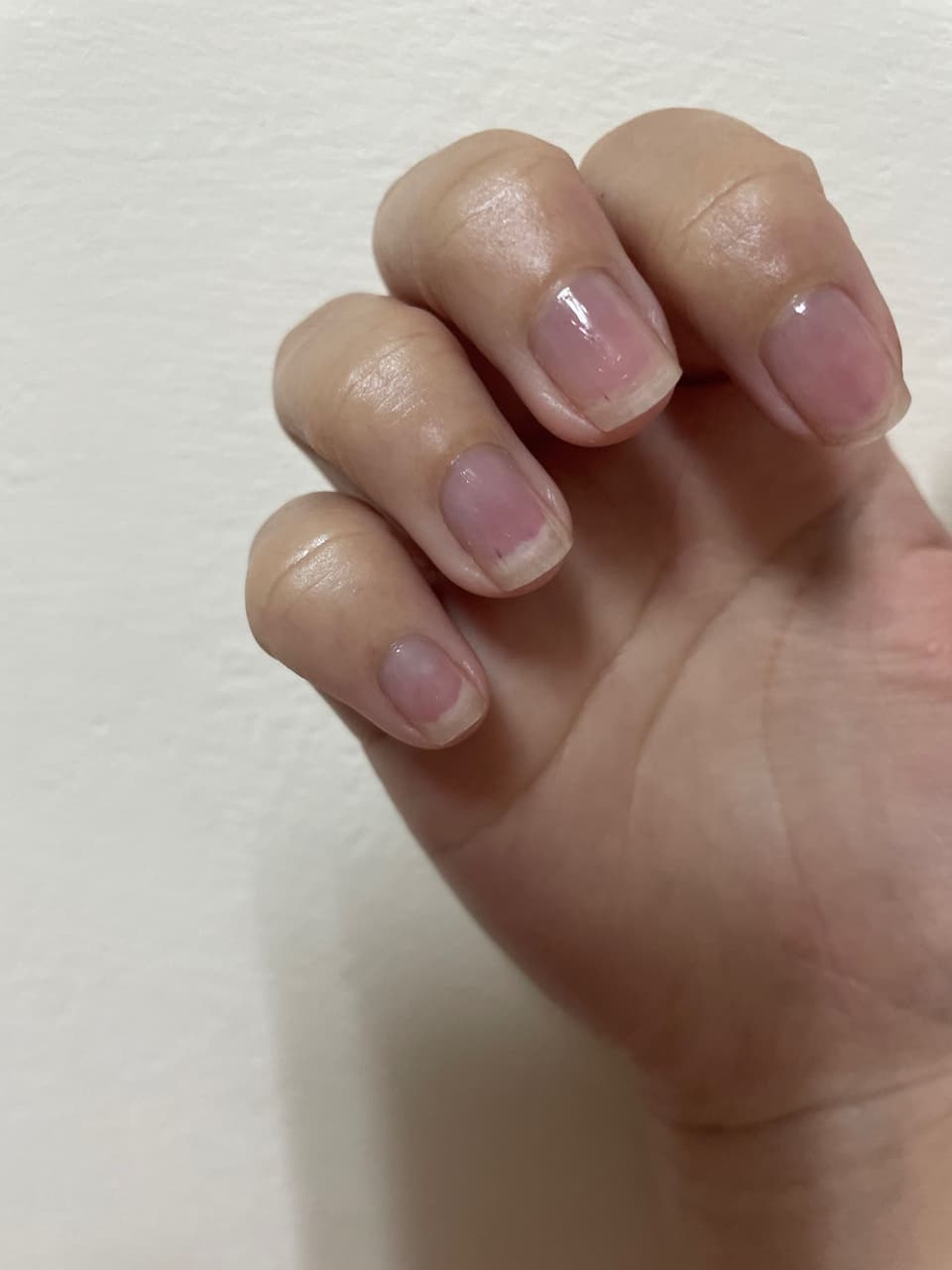 求救!這是甲床分離嗎? 美甲板 Dcard