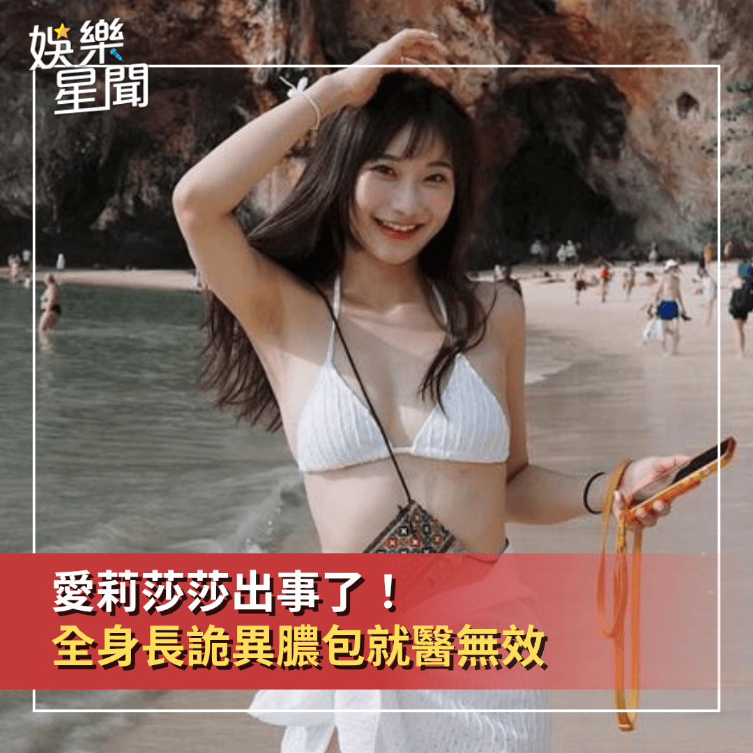 愛莉莎莎出事了！全身長詭異膿包多次就醫仍無效 27歲驚罹「癌前體質」 - SETN三立新聞網 (@setn54) | Dcard
