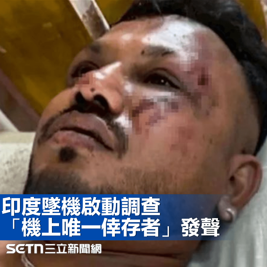 印度墜機事故啟動正式調查「機上唯一倖存者」發聲：不記得如何離開飛機 - SETN三立新聞網 (@setn54) | Dcard
