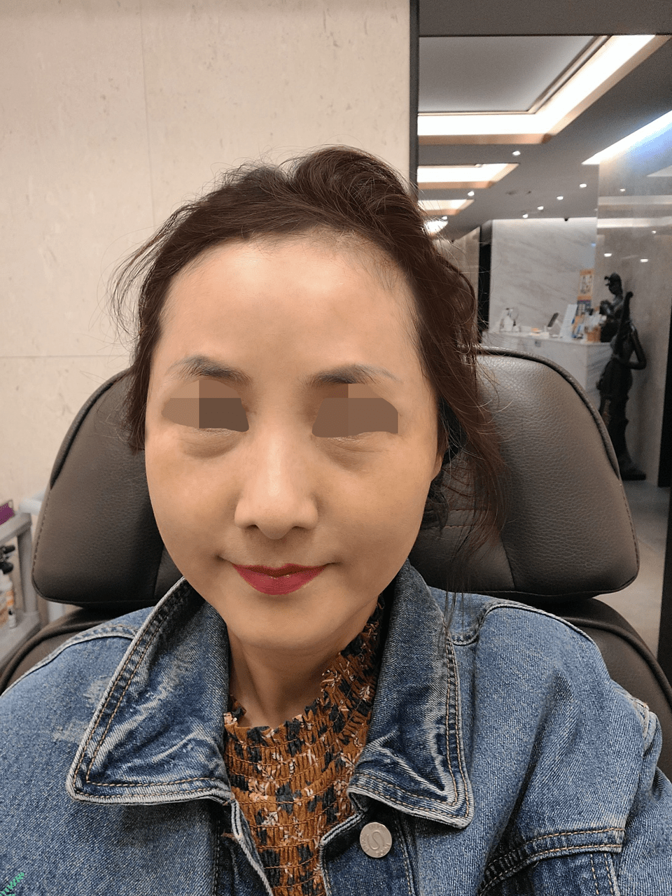 #分享 來韓國做醫美後，感覺自己真的有變年輕！ - 醫美板 | Dcard