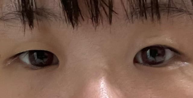 請益雙眼皮貼貼法 美妝板 Dcard