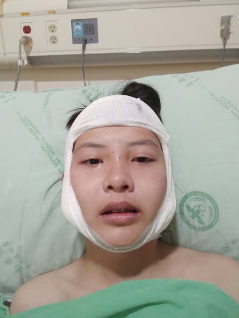 #分享 正顎手術10天ㄉ變化 (圖多文長) - B65 留言 | Dcard