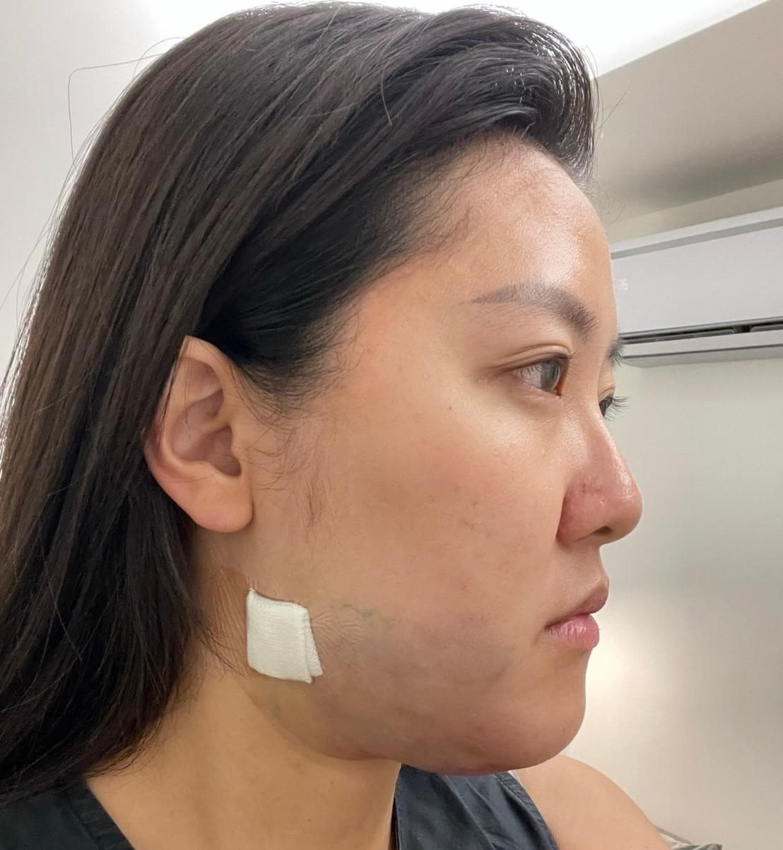 #分享 終於找回我的輪廓線 雙下巴消失全紀錄!! - 狂愛日本的女紙 (@der0311) | Dcard