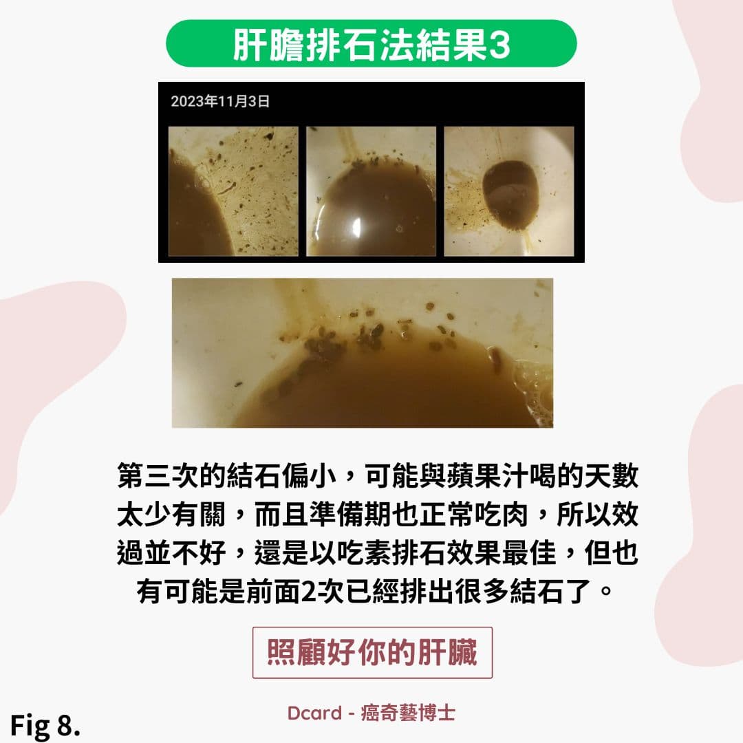 肝膽排石法的3次實際體驗過程與心得(文長，有屎照) - 癌奇藝博士 (@gd810424) | Dcard