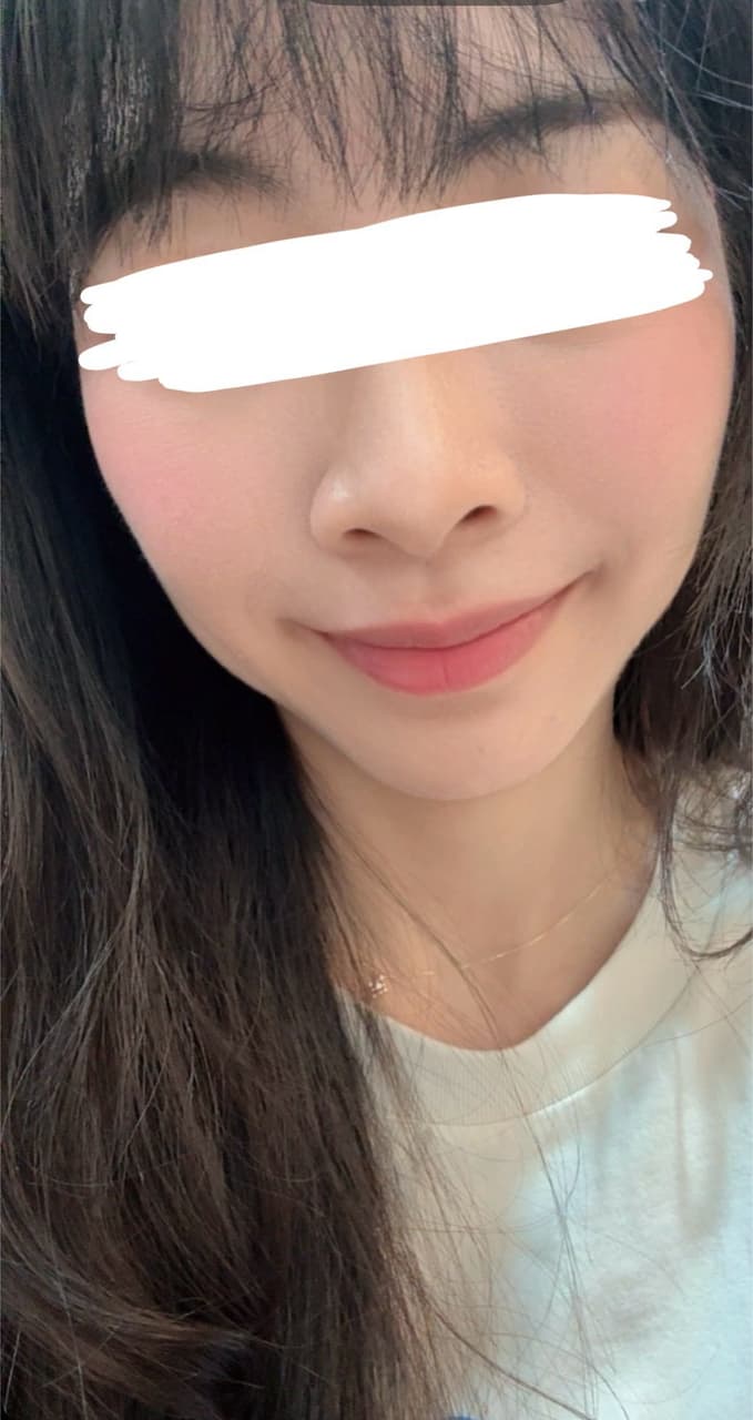 (更新）矯正後笑容變不好看？ - B159 留言 | Dcard