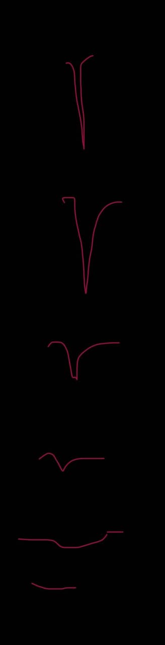 #討論 分享 ｜ 幫先生用TCA及早C晚A保養 - 美妝板 | Dcard