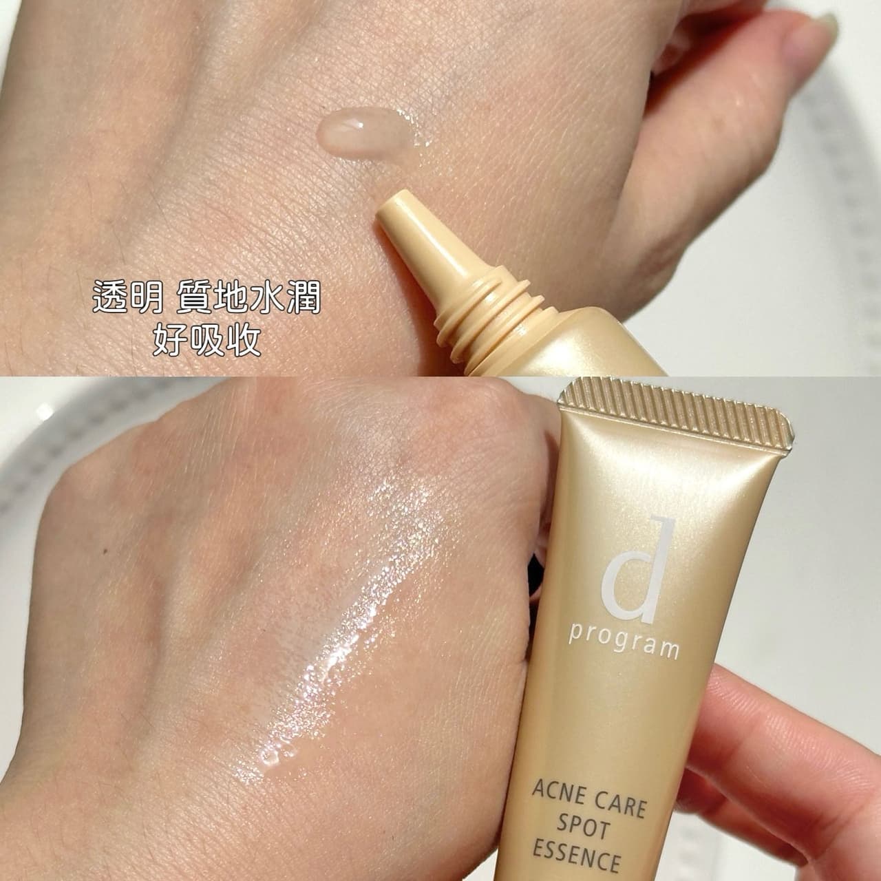 皮膚又在發瘋了嗎？你需要#d program 敏感話題💛 - 摸你卡撐 (@vivi47) | Dcard