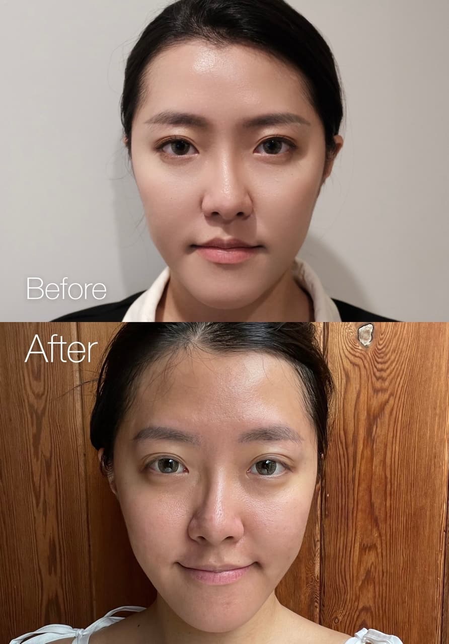 #分享 終於找回我的輪廓線 雙下巴消失全紀錄!! - 狂愛日本的女紙 (@der0311) | Dcard