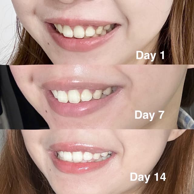 #分享 Crest美白牙膏14天實測！ - 美妝板 | Dcard