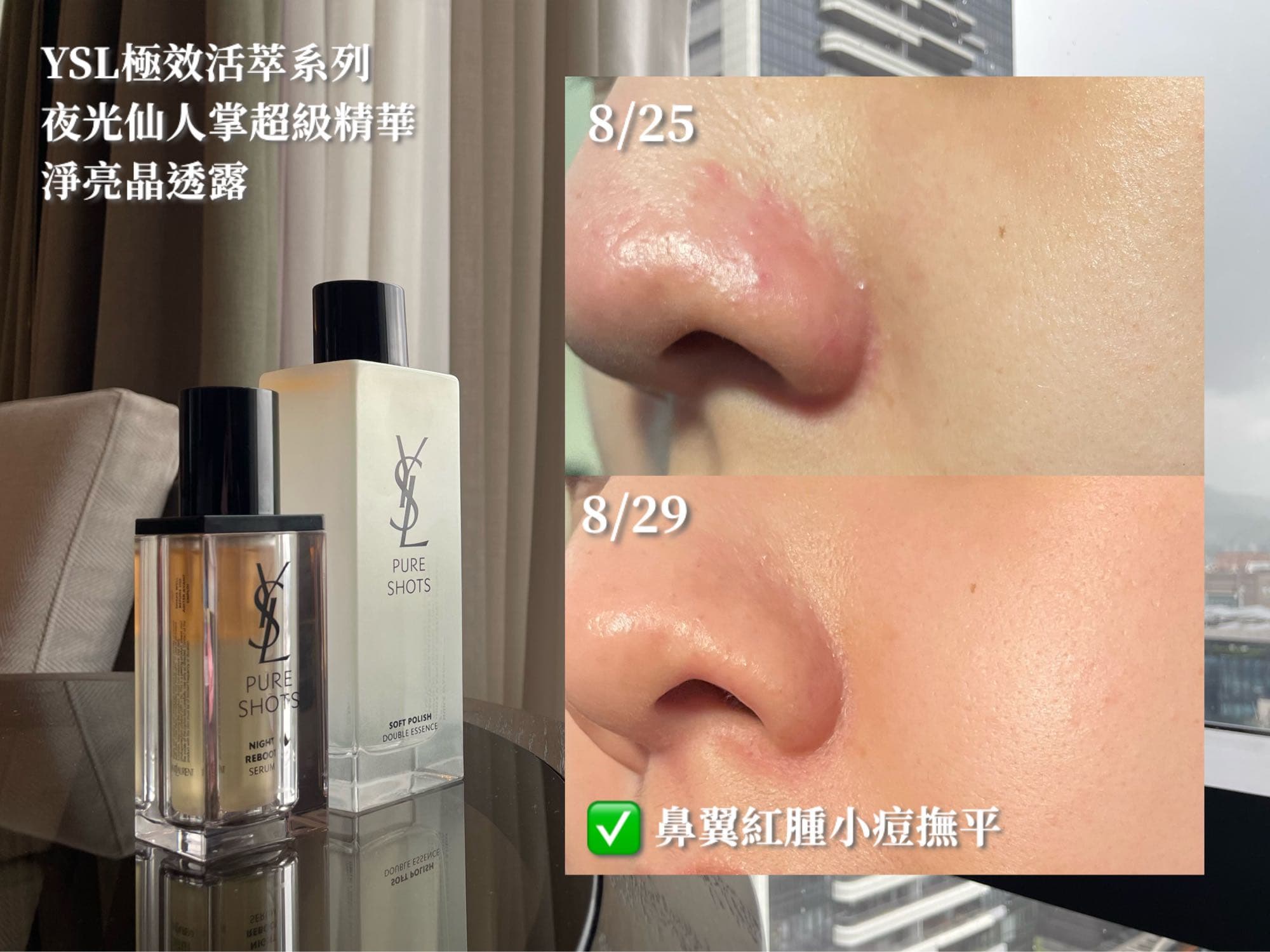 我很喜歡的酸類精華（我有回購）｜YSL仙人掌精華、仙女水 #開箱大使 - 美妝板 | Dcard