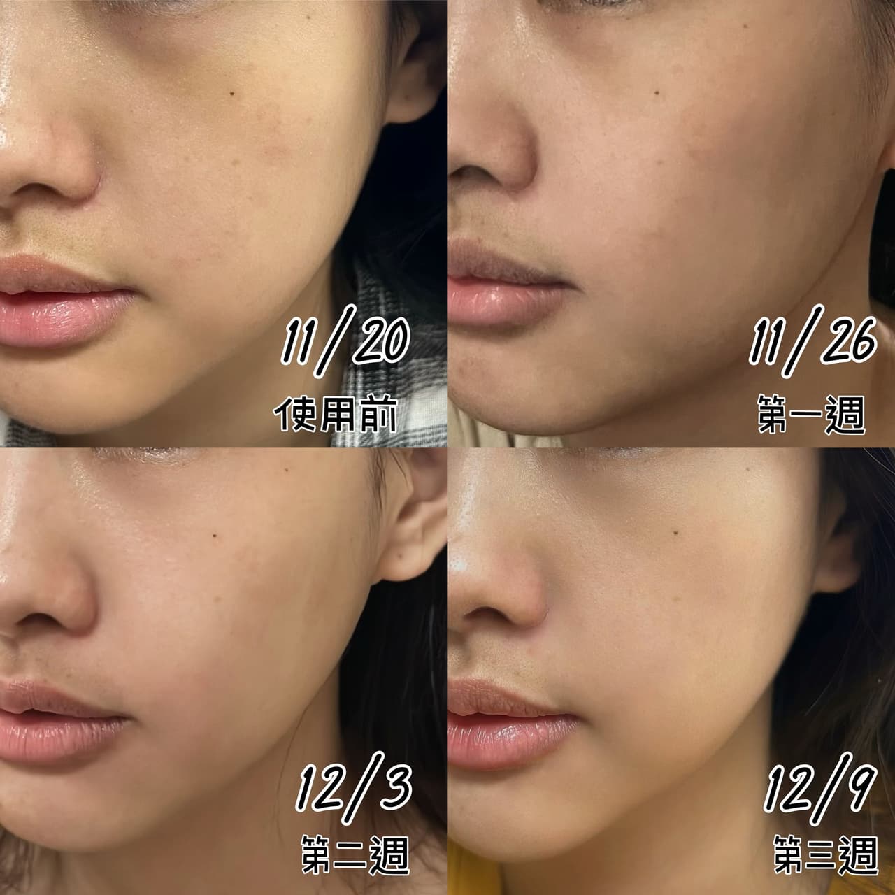 原來我的肌膚會發光呀🤍｜UNICAT 超能精華原液 - 呷雯卿 (@wenc1227) | Dcard