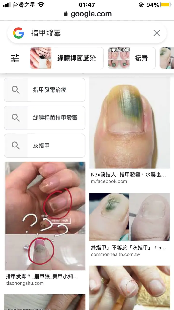 問題 甲溝藍藍的 是發霉嗎😱 美甲板 Dcard