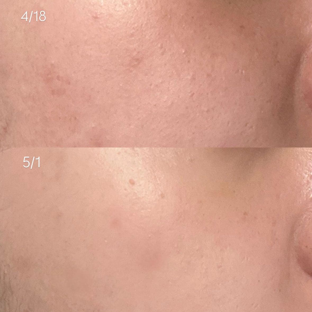 SHIMBI METHOD 審美之選 30%B3緊緻全能精華｜外泌體精華面膜｜毛孔有效細緻🧖🏻‍♀️ ˟ ̫ 🪽 ヾ - 贊助板 | Dcard