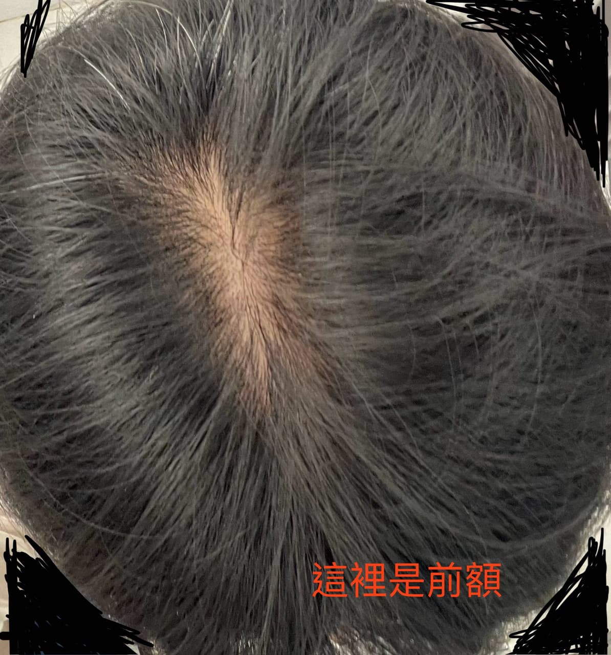 抗戰禿頭紀錄 - B14 留言 | Dcard