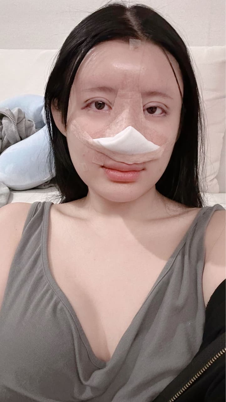 韓國江南手術D1 流水帳 - Coco Mu (@cocochubbupie) | Dcard