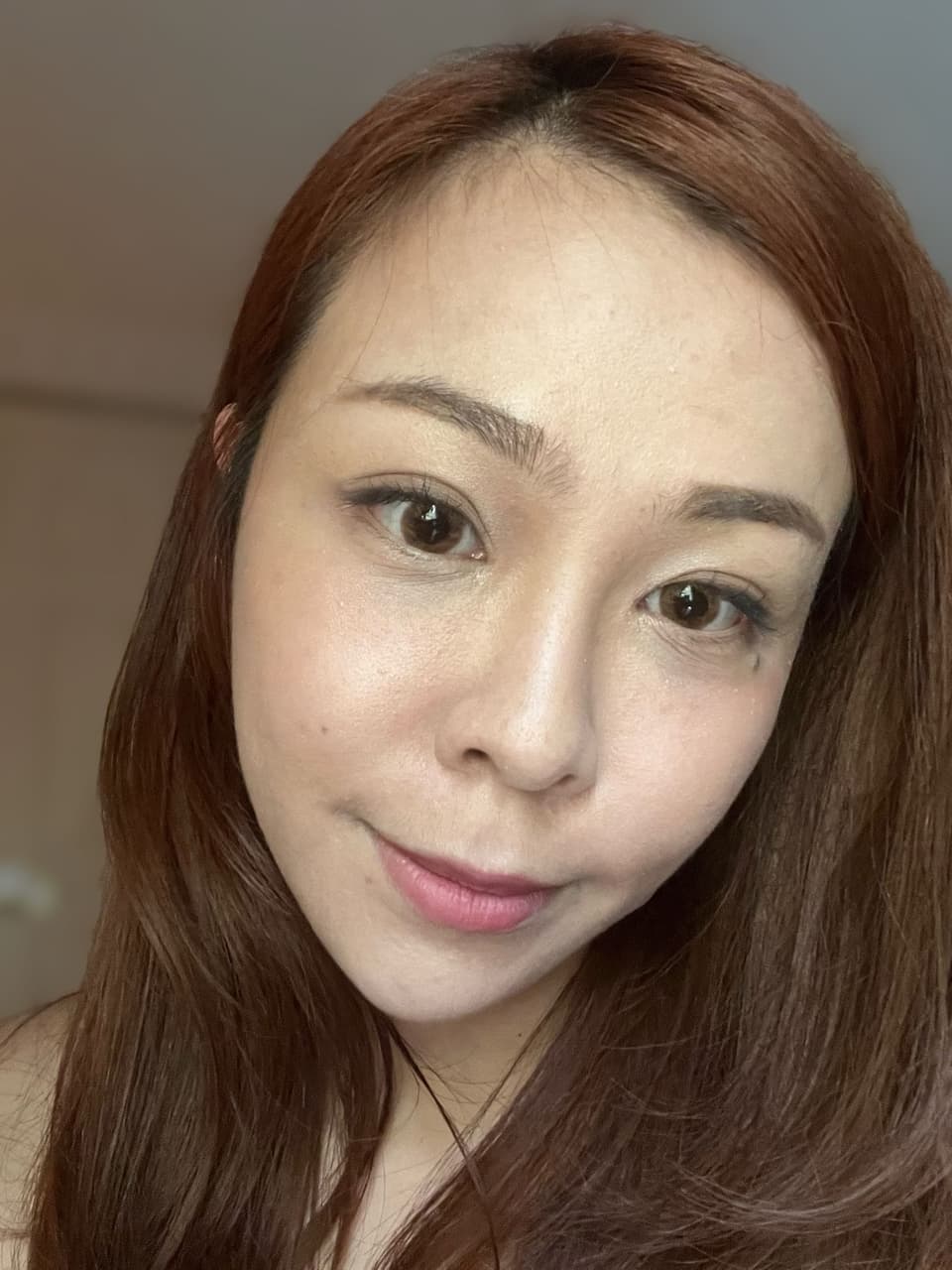 #愛美金句 人生不是天生♥️PRP自體生長因子過程+心得 - 自由媳 (@freeee_na) | Dcard