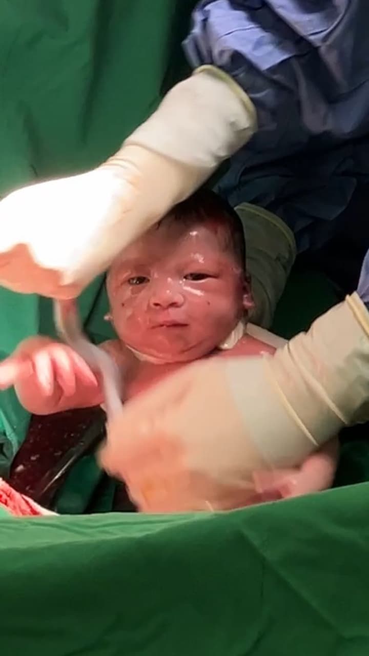 出生的第一眼是我爸 - 新光生殖中心 李毅評醫師 (@dr_williams) | Dcard