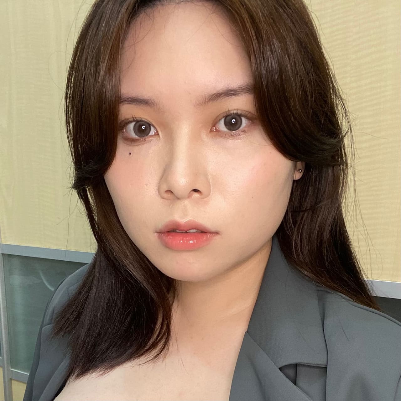 #分享 淚溝居然真的變淡 ️遺傳性淚溝+過敏黑眼圈玻尿酸紀錄｜君綺漾 #開箱大使 - 醫美板 | Dcard