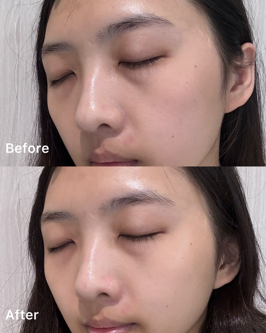 #開箱 膚況也要升級！可以天天用的日本A醇雙管精華登台了｜SHIMBI METHOD審美之選 - 美妝板 | Dcard